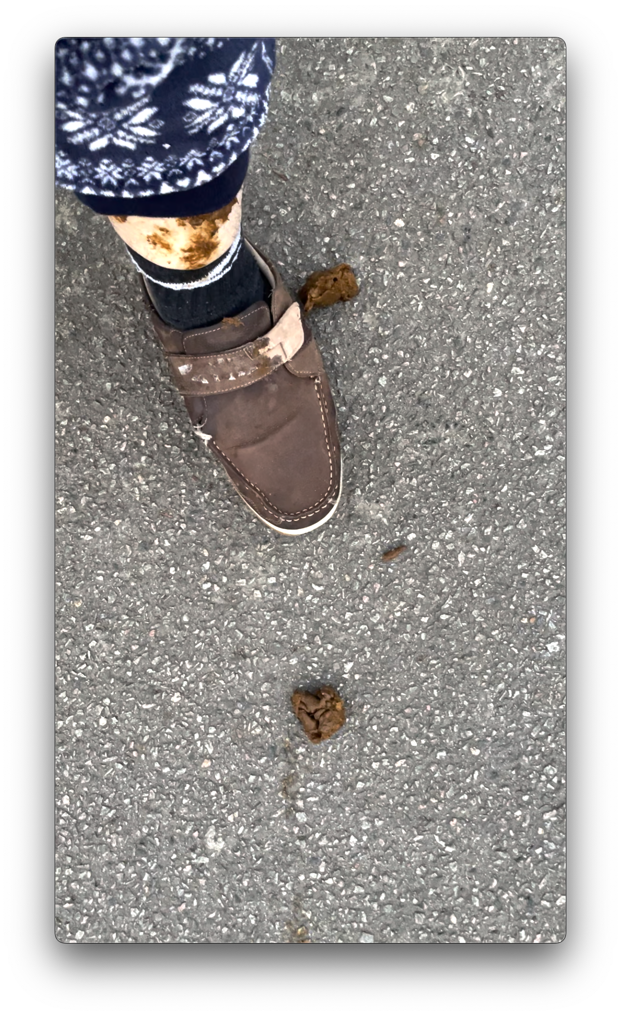 Forum caca culotte/caca couches : Entre couche et boxers