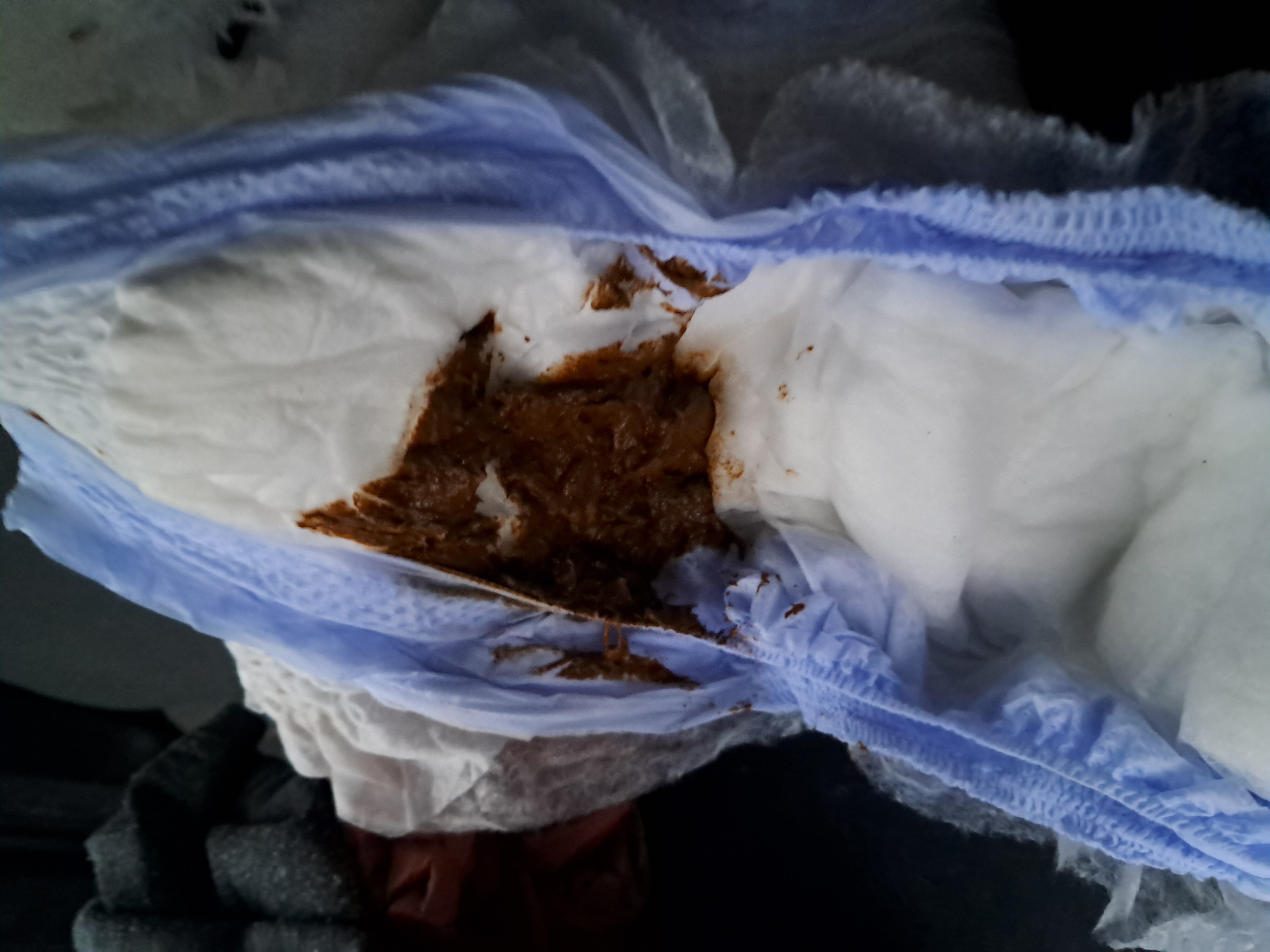 Forum caca culotte/caca couches : Pipi caca couche