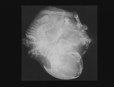 lithopedion - JungleKey.fr Image #50